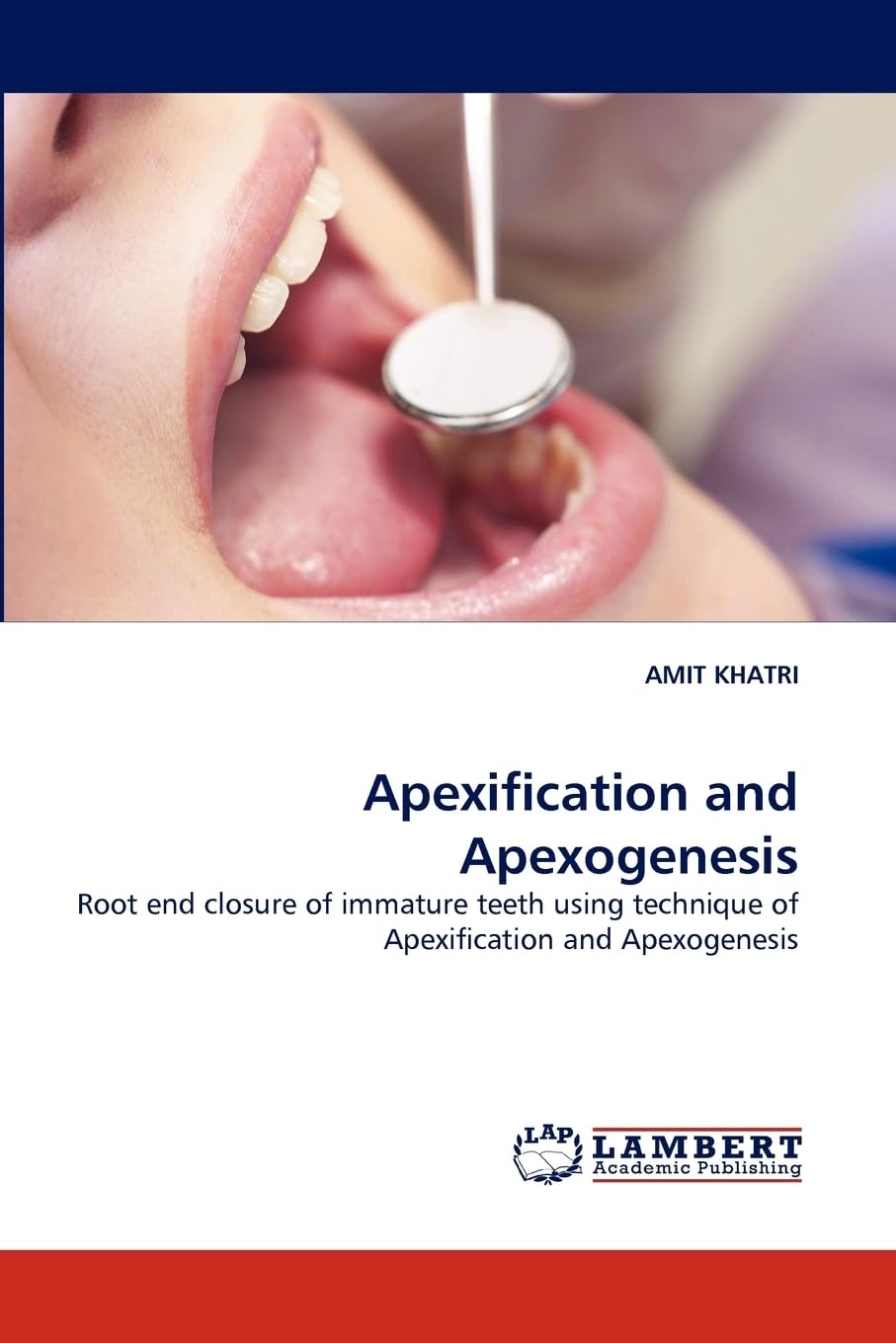 Apexification and Apexogenesis: Root end closure of immature teeth ...