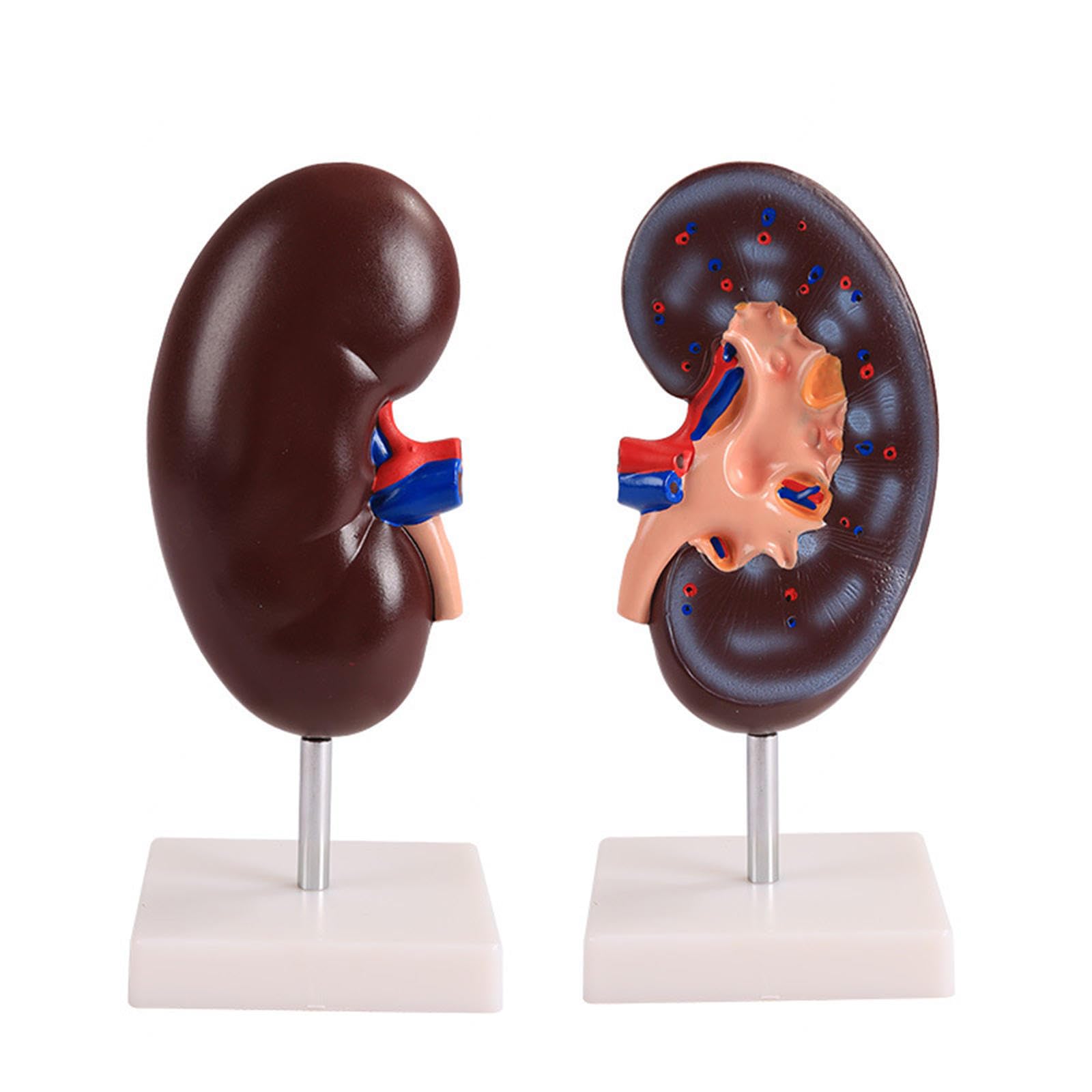Buy Life-Size Kidney Model, Showing Internal Structure A Normal Kidney ...