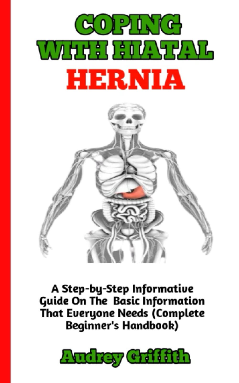 Coping With Hiatal Hernia The Perfect Informative Guide To ...