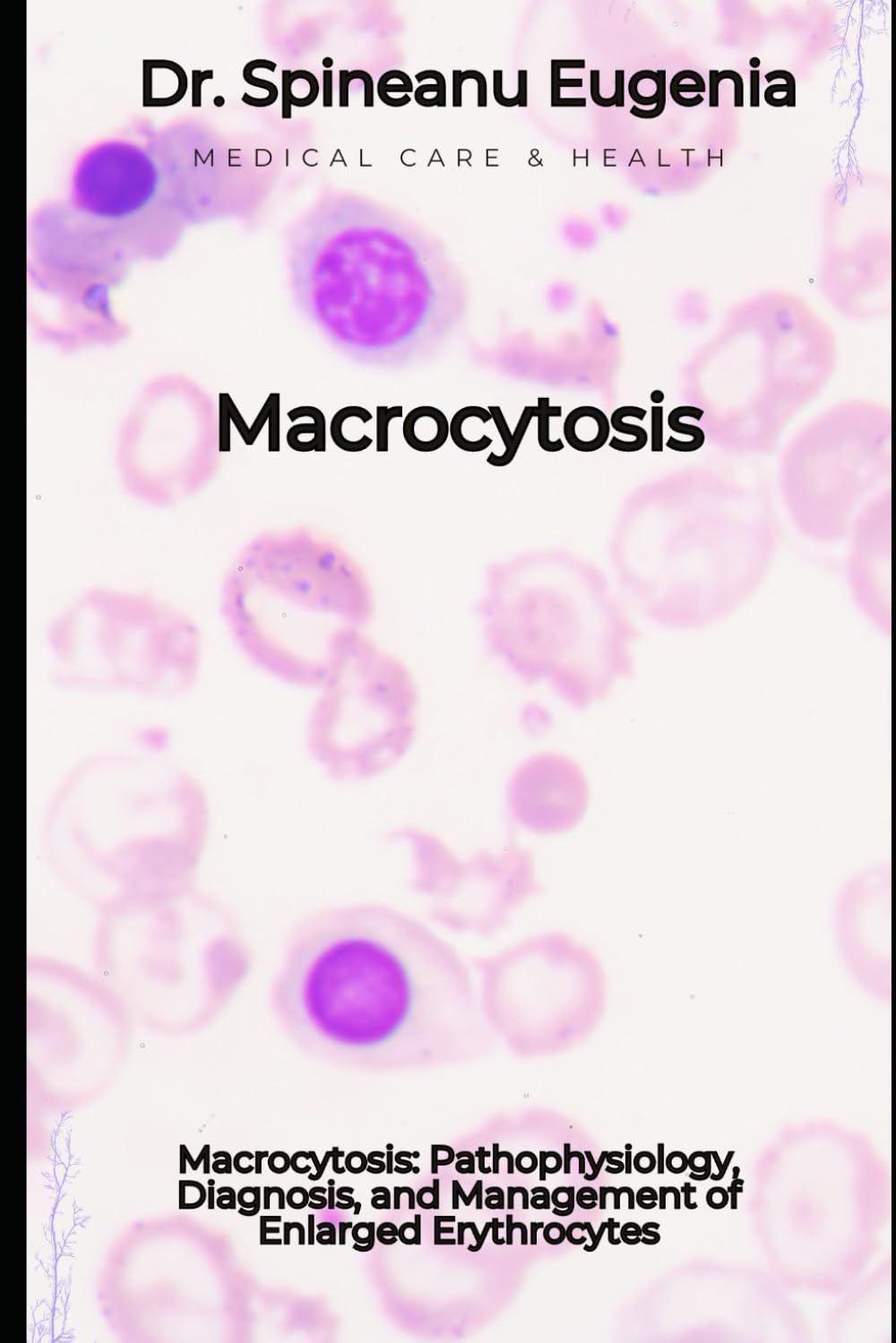 Macrocytosis