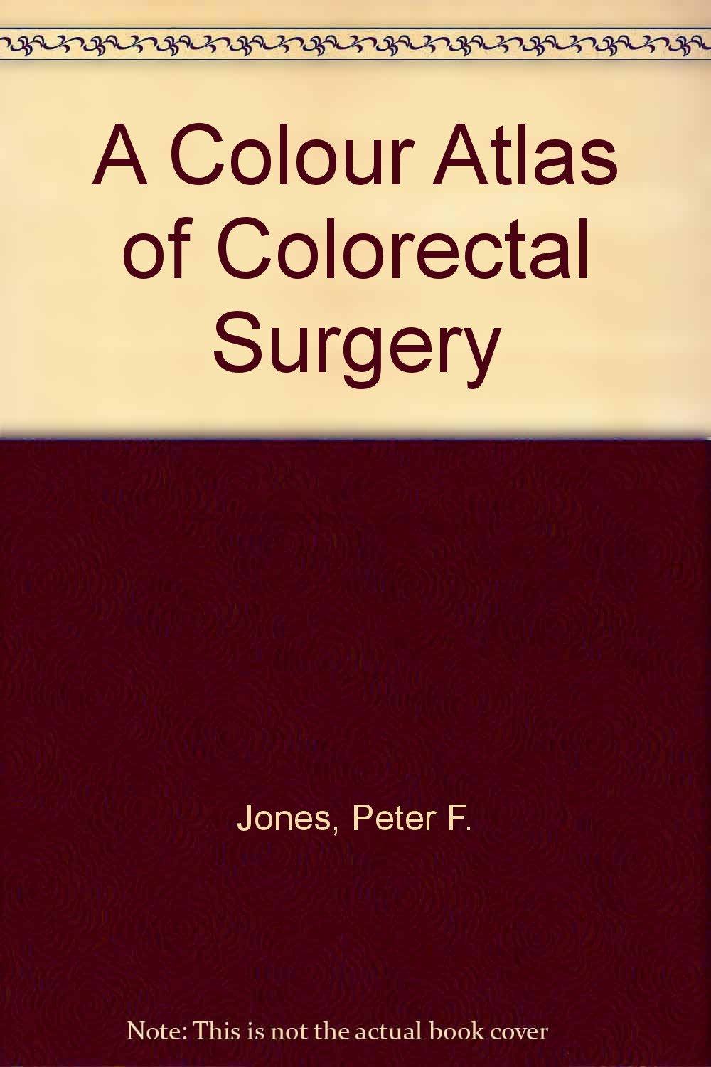 Amazon | A Colour Atlas of Colorectal Surgery | Jones, Peter F., Siwek ...