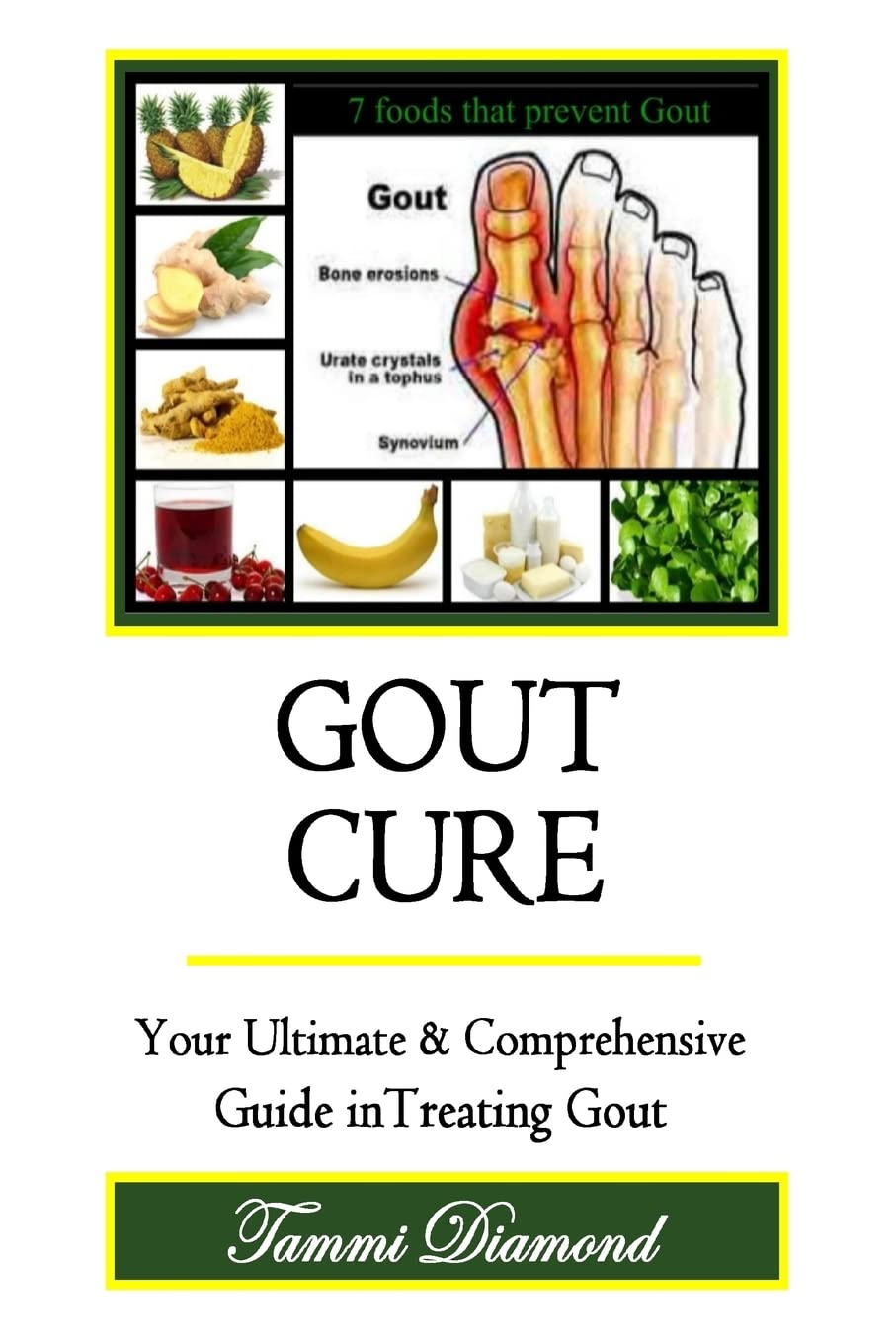 Gout Cure: Your Ultimate and Comprehensive Guide in Treating Gout (Gout ...