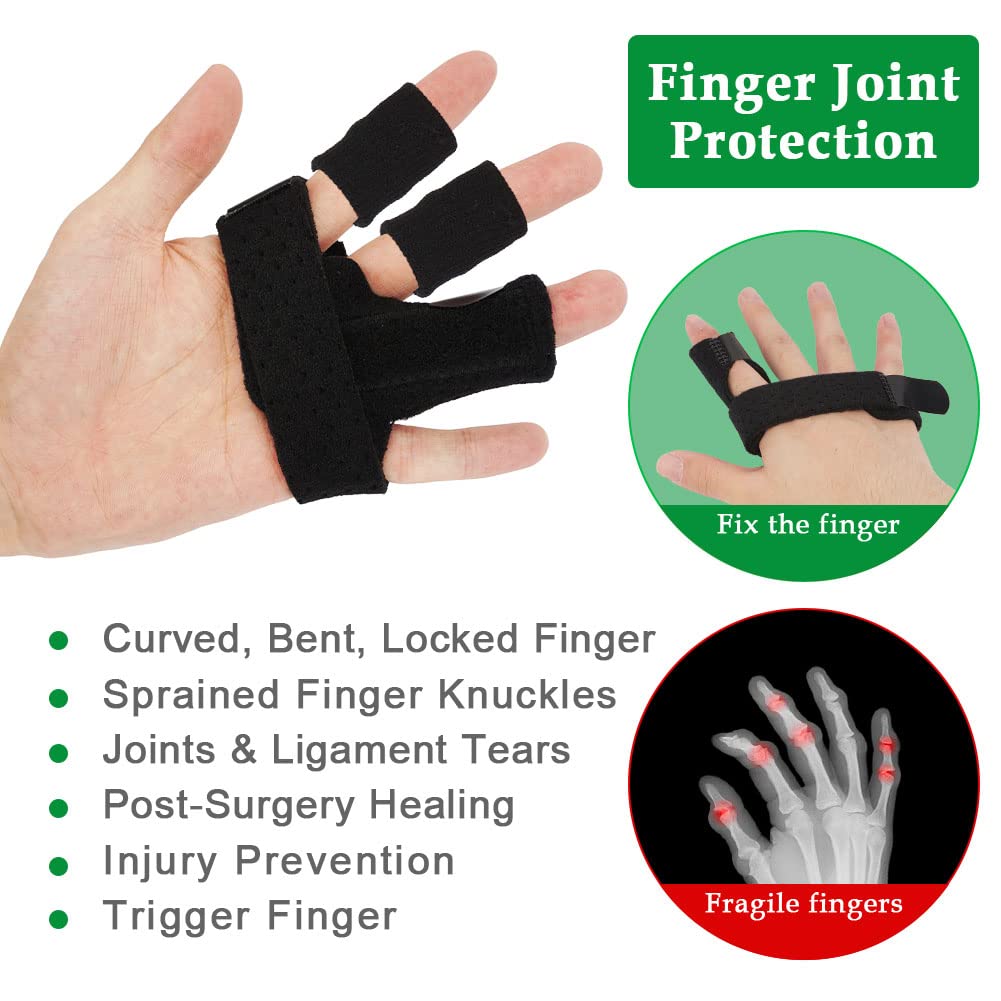 6PCS Finger Splint – Broken Finger Support – Thumb Fractures Sprains ...