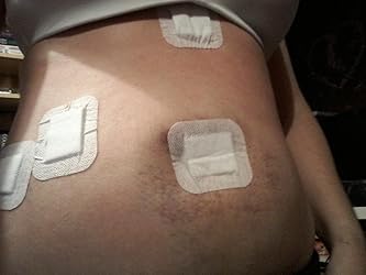 Softpore 6cm x 7cm Wound Dressings Pack of 60 - Adhesive, Ultra ...
