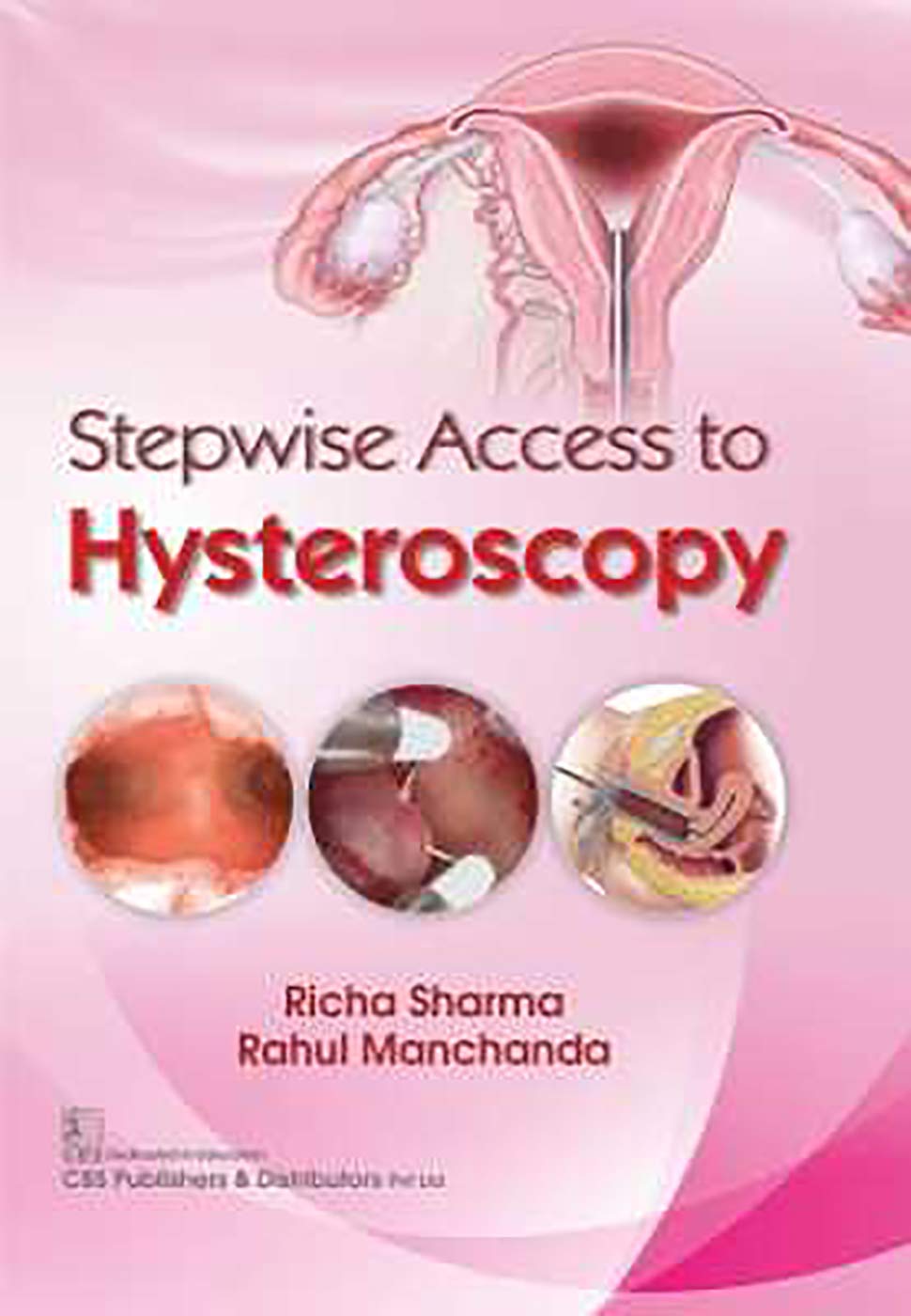 Stepwise Access to Hysteroscopy: 9789389688535: Medicine & Health ...