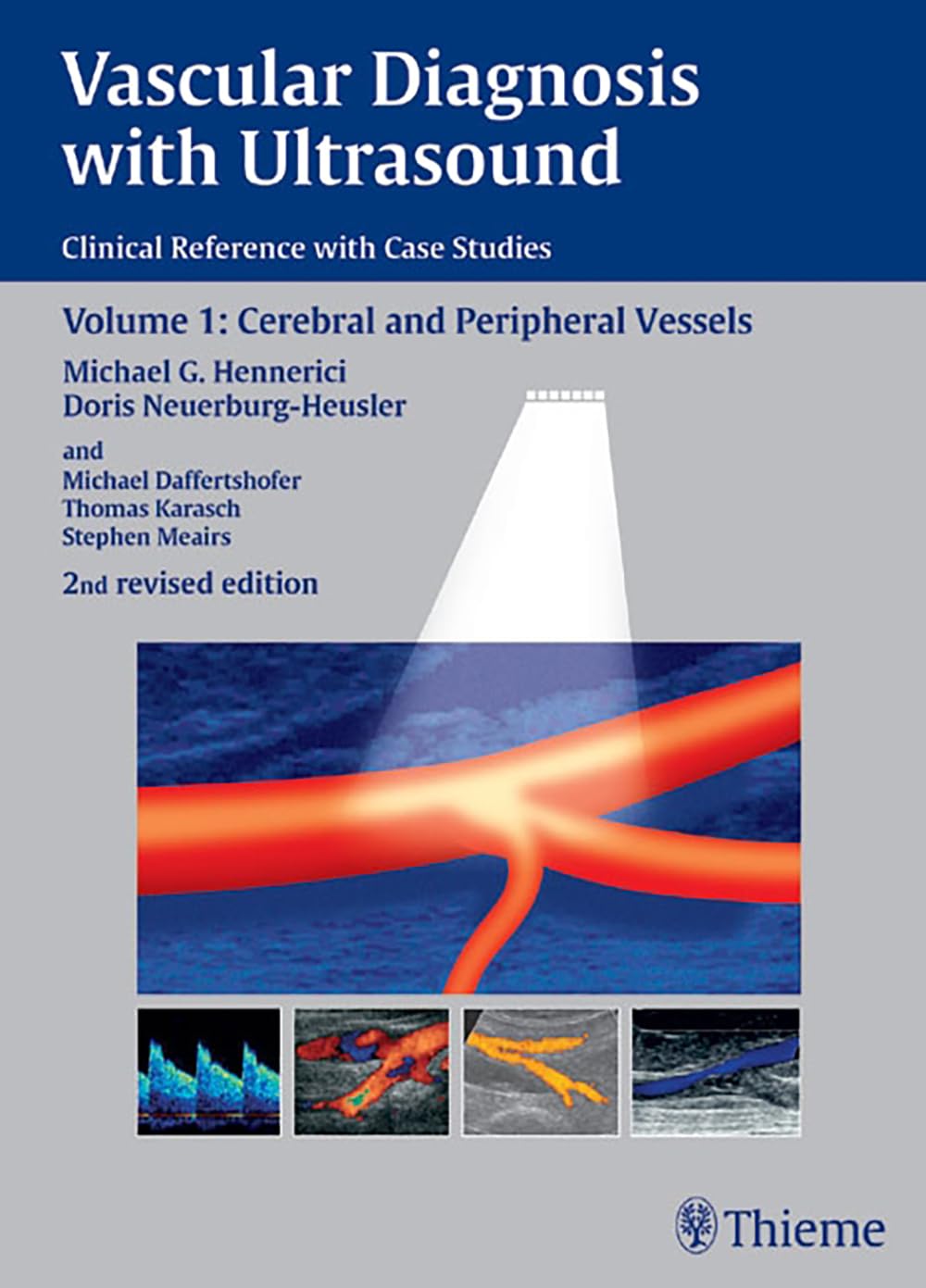 Vascular Diagnosis with Ultrasound: Clinical Reference with Case ...