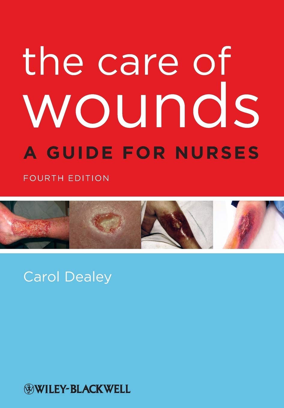 The Care of Wounds: A Guide for Nurses, 4th Edition : Dealey, Carol ...