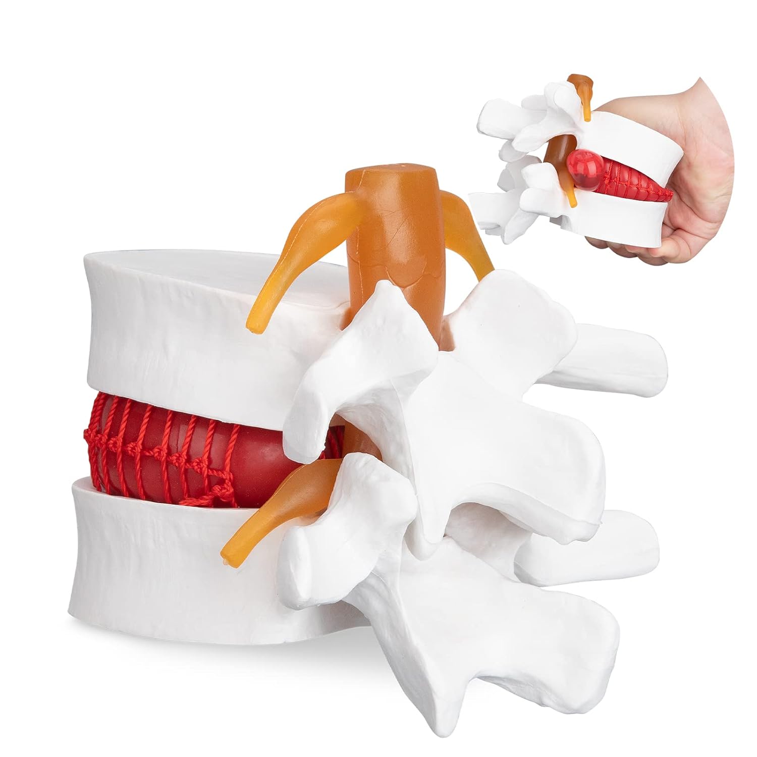 LVCHEN Disc Herniation Model - Human Lumbar Disc Herniation Spine Model ...