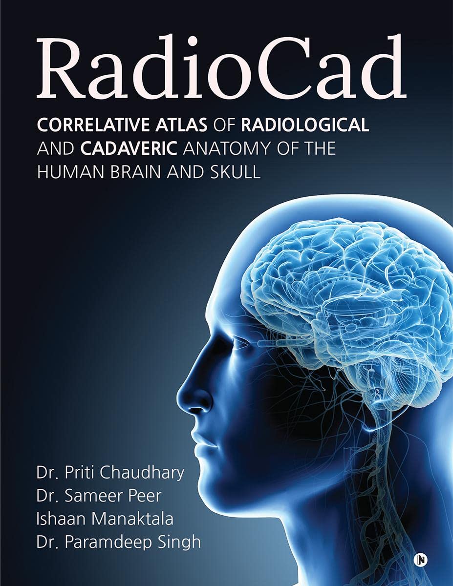 Buy RadioCad: Correlative Atlas of Radiological and Cadaveric Anatomy ...