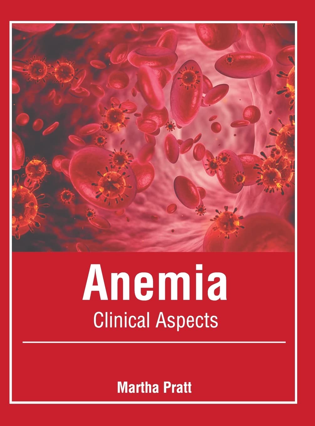Anemia: Clinical Aspects: 9781639271795: Medicine & Health Science ...