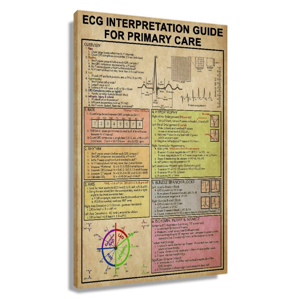 Amazon.com: Ecg Medical Wall Art Knowledge Poster Vintage ...