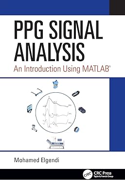 Amazon | PPG Signal Analysis: An Introduction Using MATLAB® | Elgendi, Mohamed | Palm OS