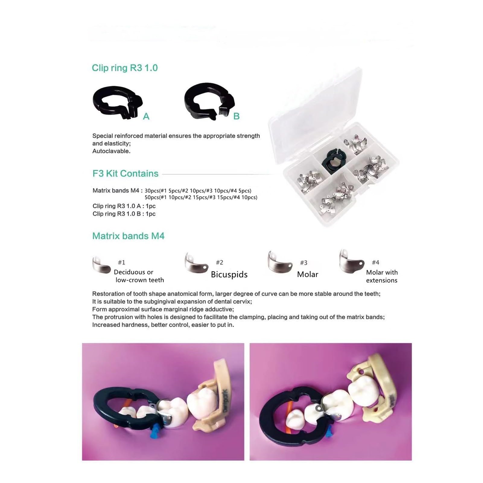 Snapklik.com : Dental Sectional Matrix System Kit, Dental Sectional ...
