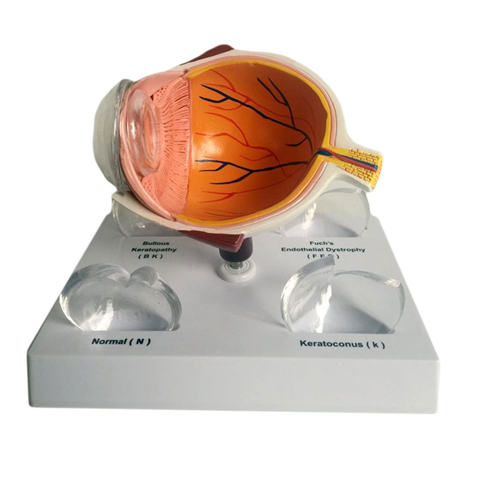 Buy Removable Cataract Eye Model, Half Eye Anatomical Model Corneal ...
