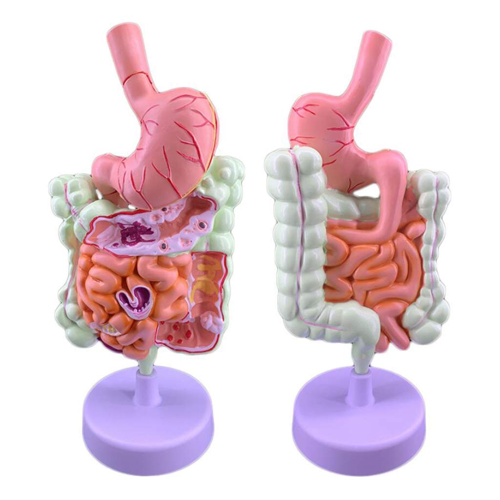 Buy Large Intestine Model Colonic Pathology Model trointestinal Colonic ...