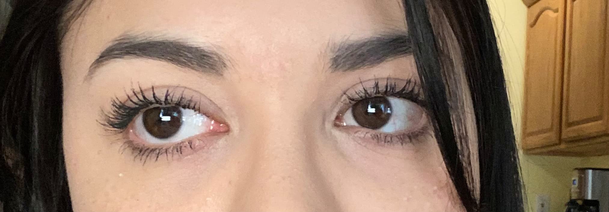 $11/mo - Finance Dermaflage Scar Filler Kit - Medium - Deep Scar Cover ...