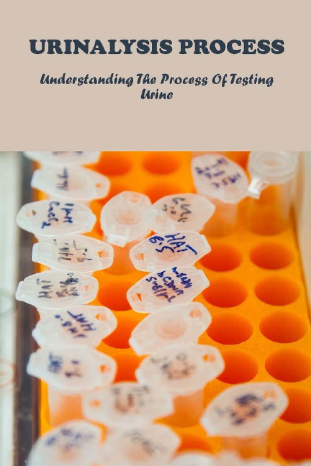 Urinalysis Process: Understanding The Process Of Testing Urine ...