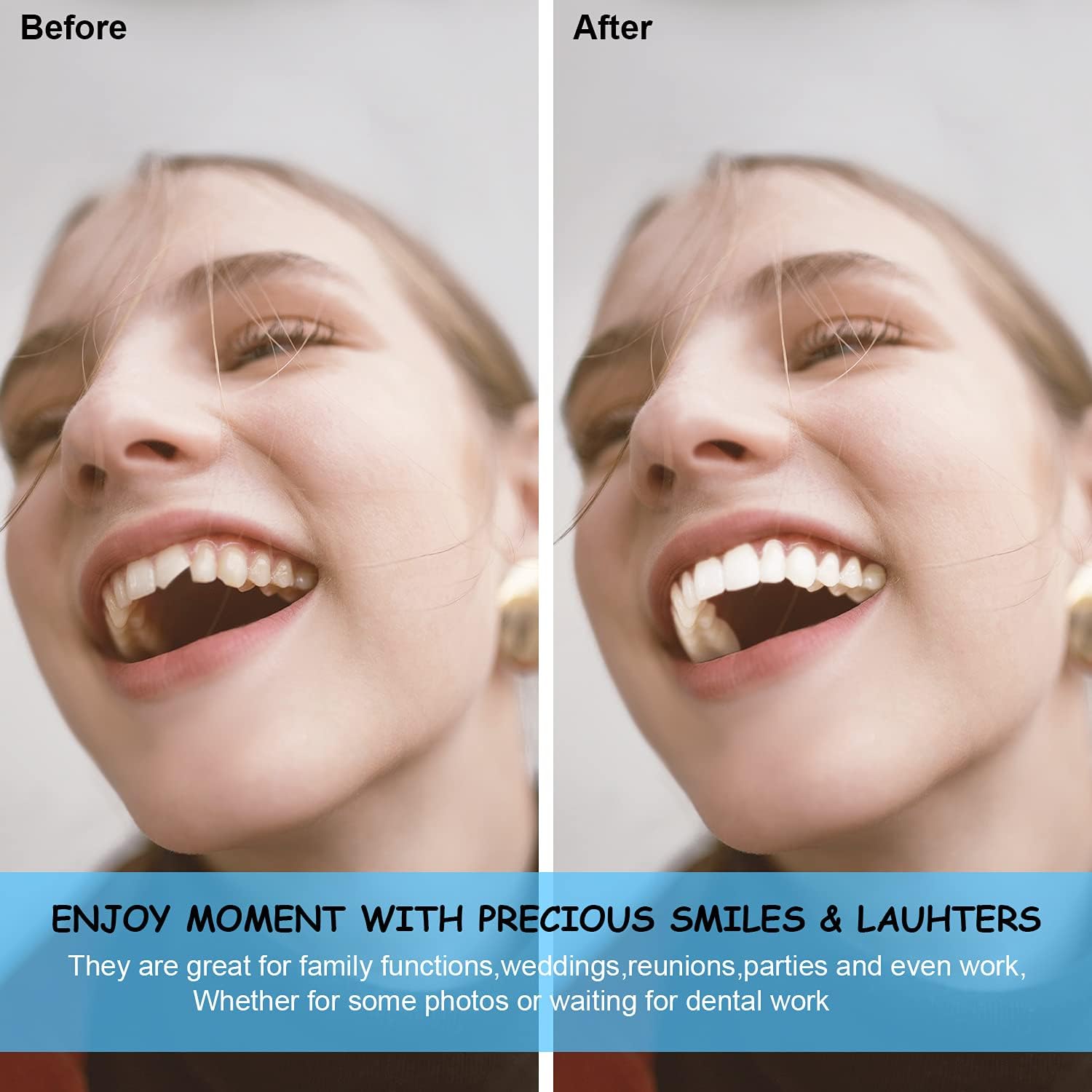 2 Pieces Instant Veneers Dentures, 50g Multi-Functional Temporary Tooth ...