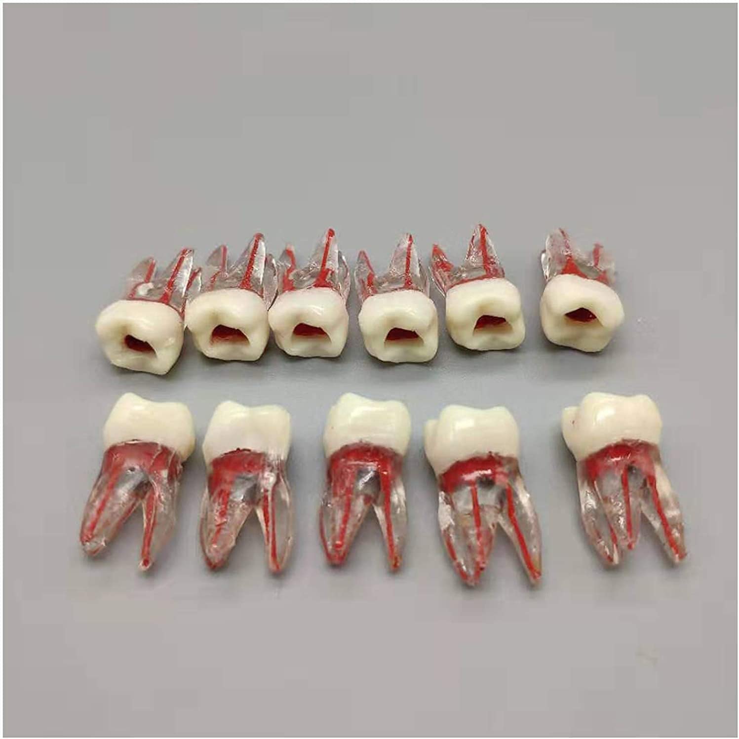 Anatomía Del Conducto Radicular Odontología Con Cri La Cámara