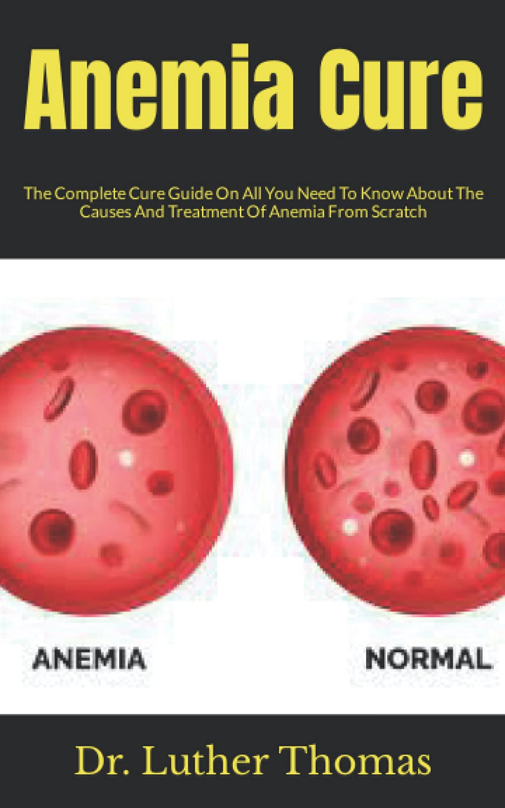 Buy Anemia Cure: The Complete Cure Guide On All You Need To Know About ...