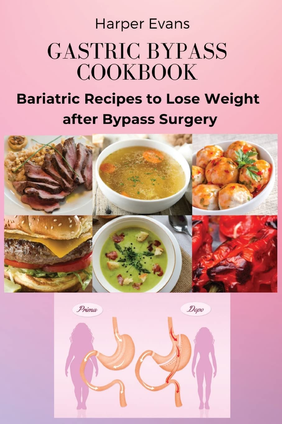 Gastric Bypass Cookbook: Bariatric Recipes to Lose Weight after Bypass ...