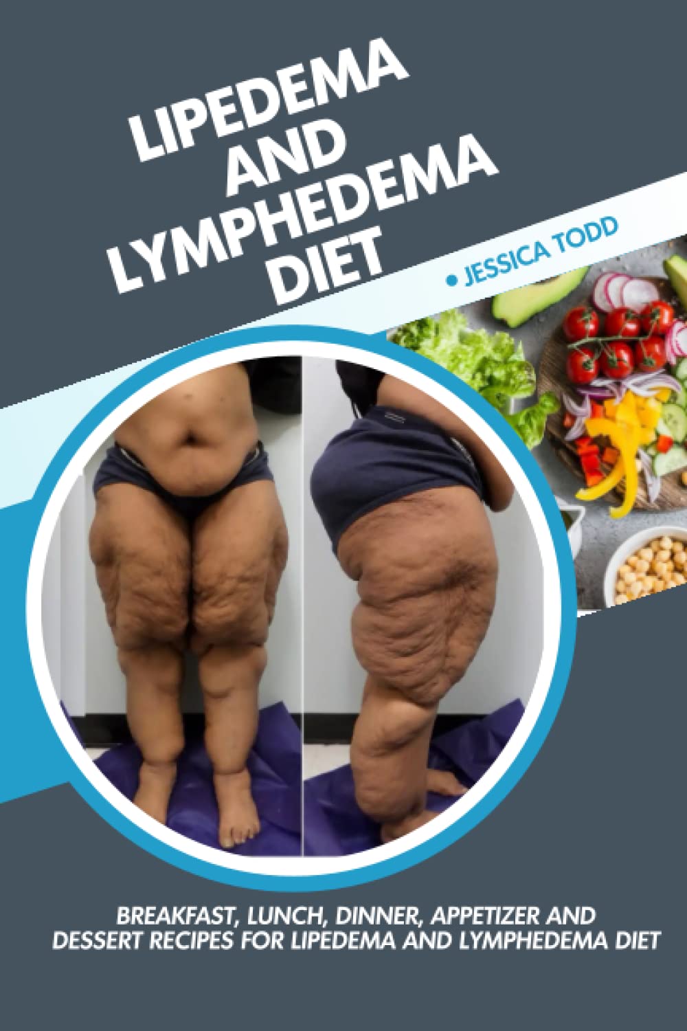 Buy Lipedema and Lymphedema Diet: Breakfast, Lunch, Dinner, Appetizer ...