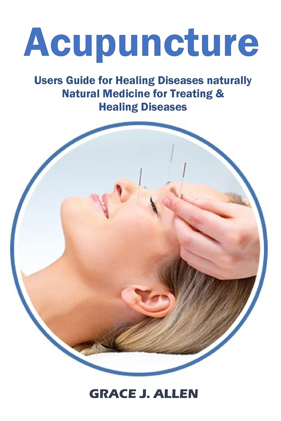 Acupuncture: Users Guide for Healing Diseases naturally Natural ...