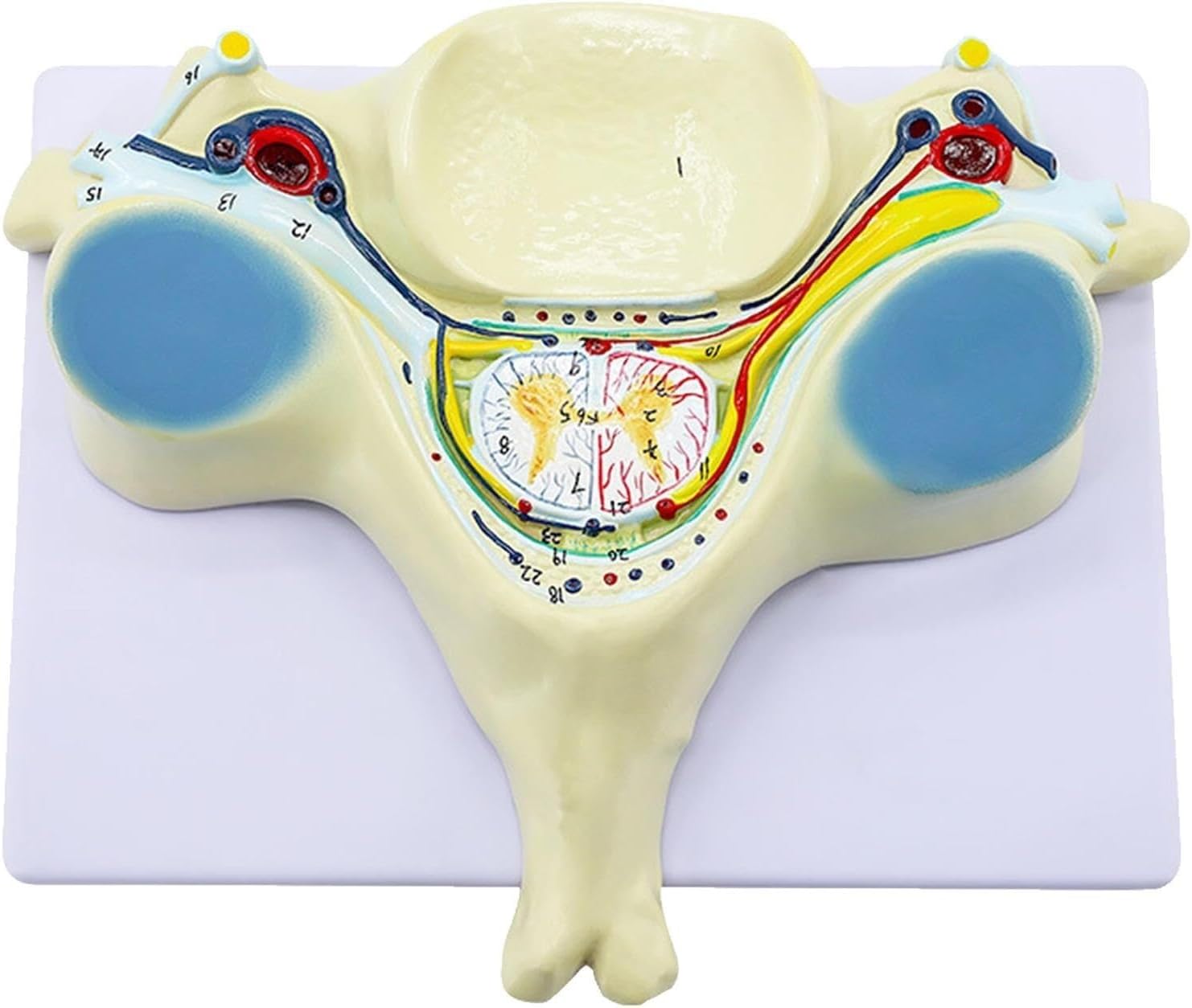 Amazon.com: ZQJYMXM Spinal Anatomy, expanded Cross-Section of The Spine ...