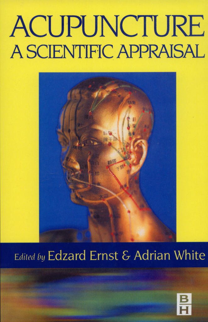 Acupuncture: Acupuncture: 9780750641630: Medicine & Health Science ...