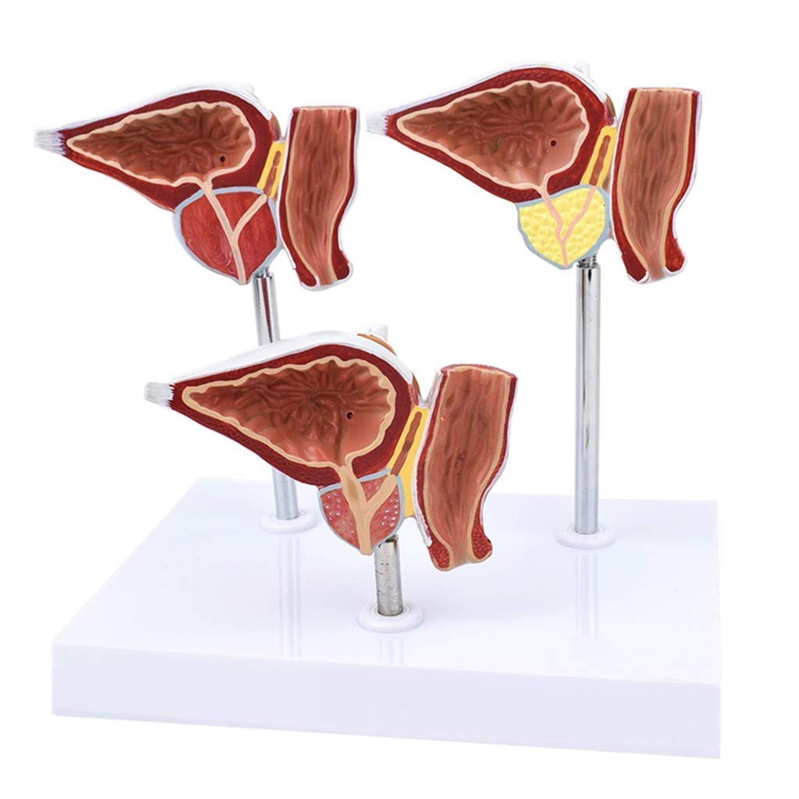 Buy FGDSA Body Model Human Anatomical Prostate Model-1:1 Life Size ...