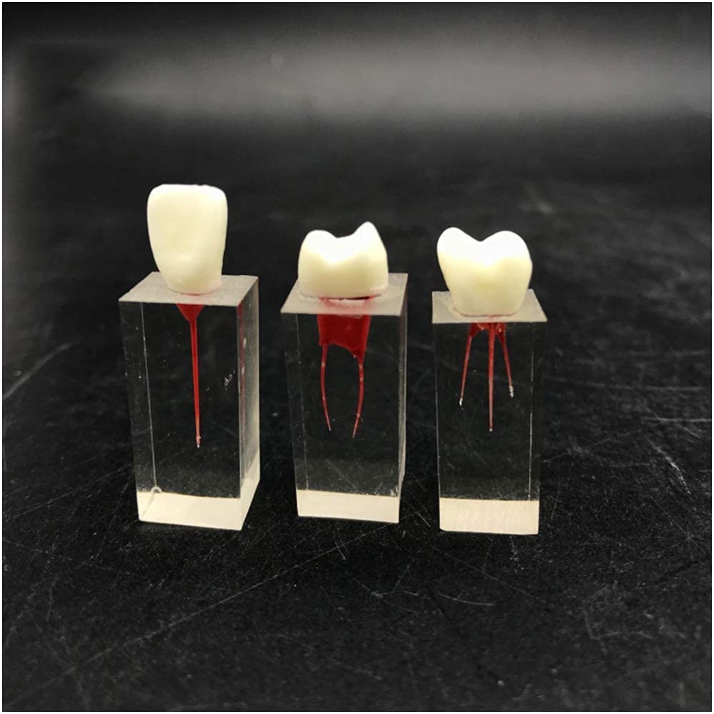 Buy Anatomy Teeth Model - Open Pulp Root Canal Filling Model - 3Pcs ...
