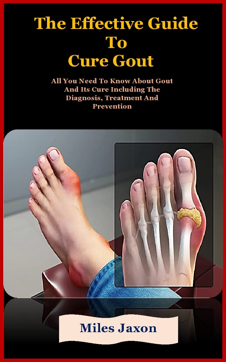 Buy The Effective Guide To Gout Cure: The Effective Guide To Gout Cure ...