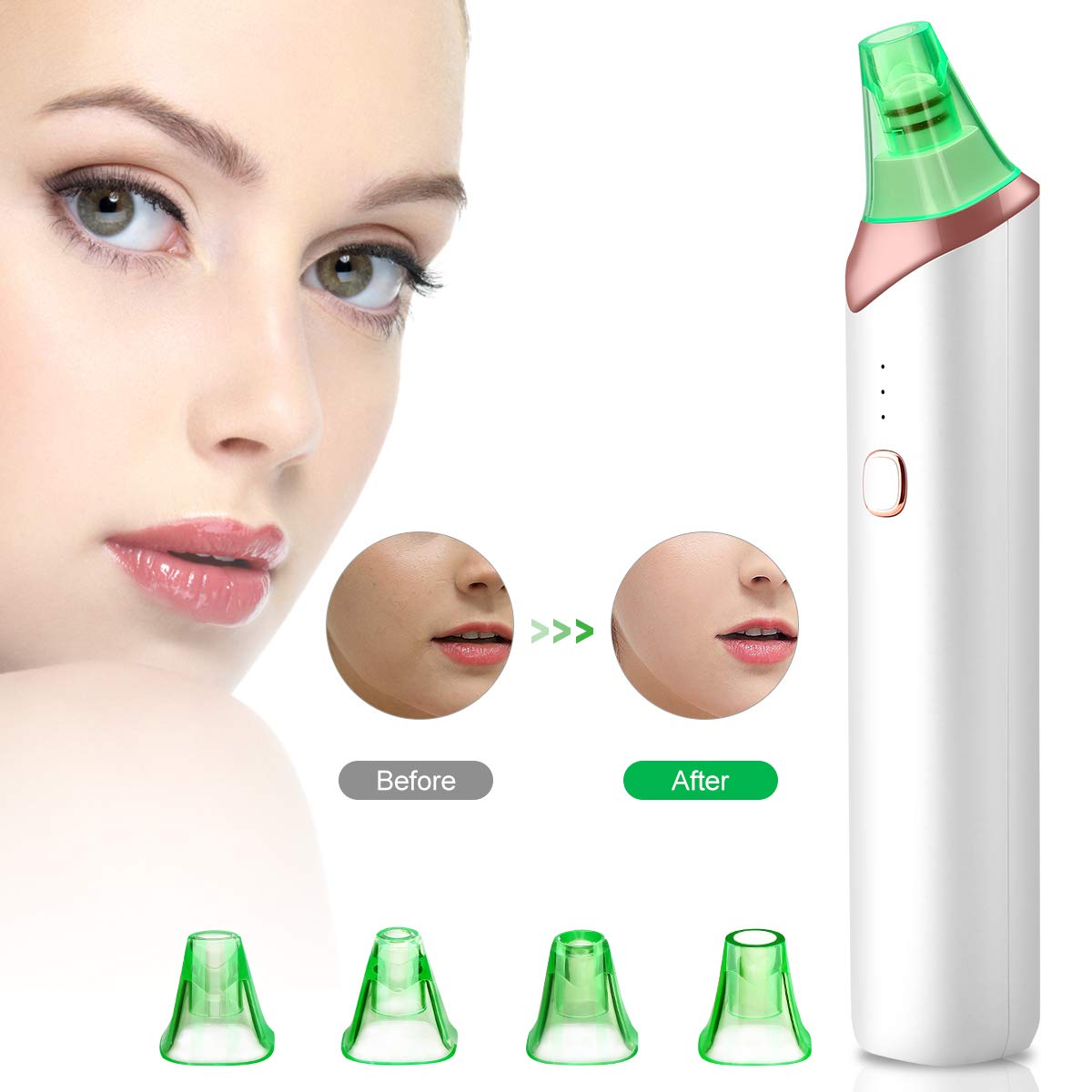 Amazon.com: Blackhead Remover,Vacuum Blackhead Removal Peel Tool ...