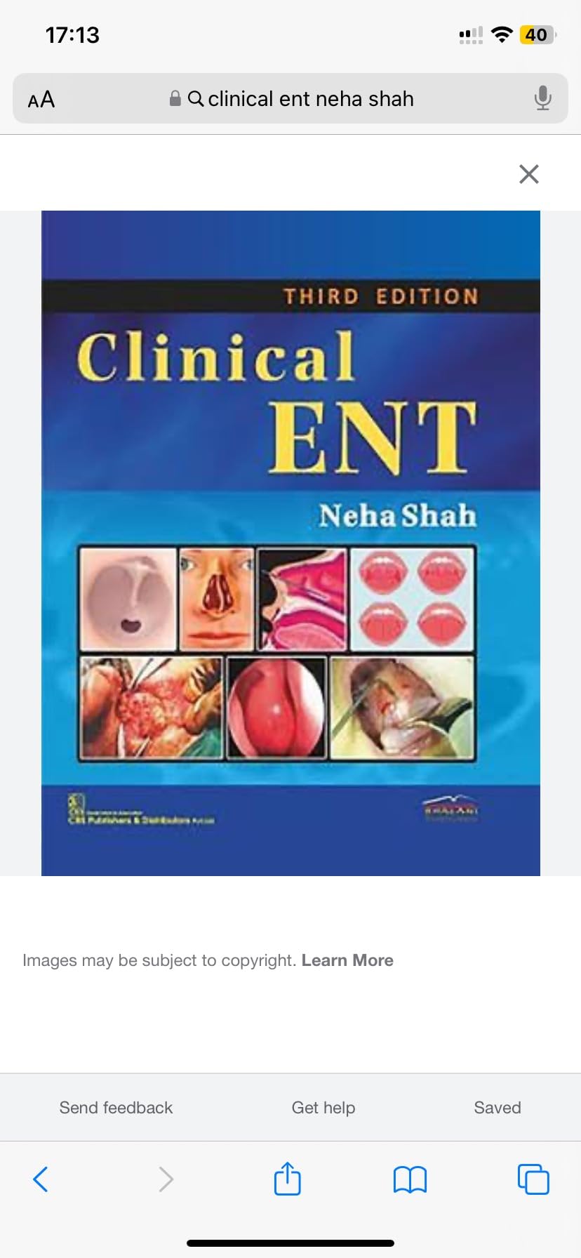 Buy Clinical ENT, 3e (HB) [Paperback] Neha Shah Book Online at Low ...