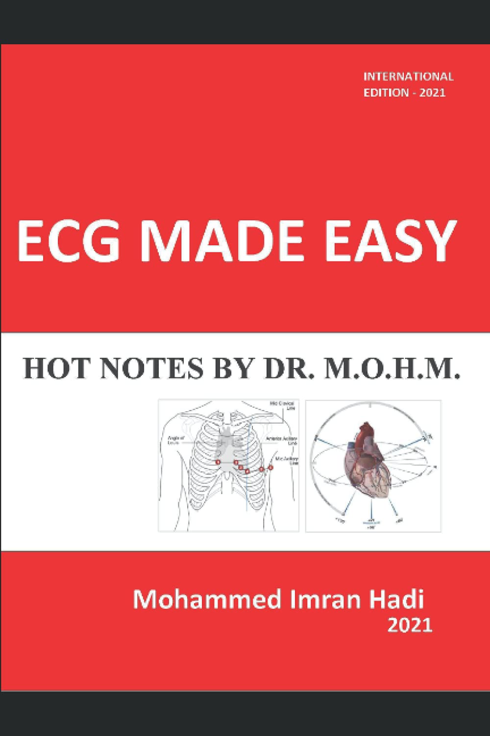 Snapklik.com : ECG MADE EASY: HOT NOTES BY DR. MOHM