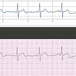 Amazon.co.jp: オムロンHCG-801用 心電図印刷ソフト HCG-SOFT-2 : 産業・研究開発用品
