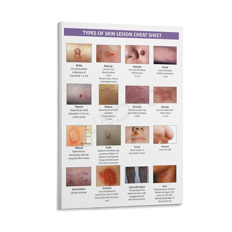 Skin Lesions Chart
