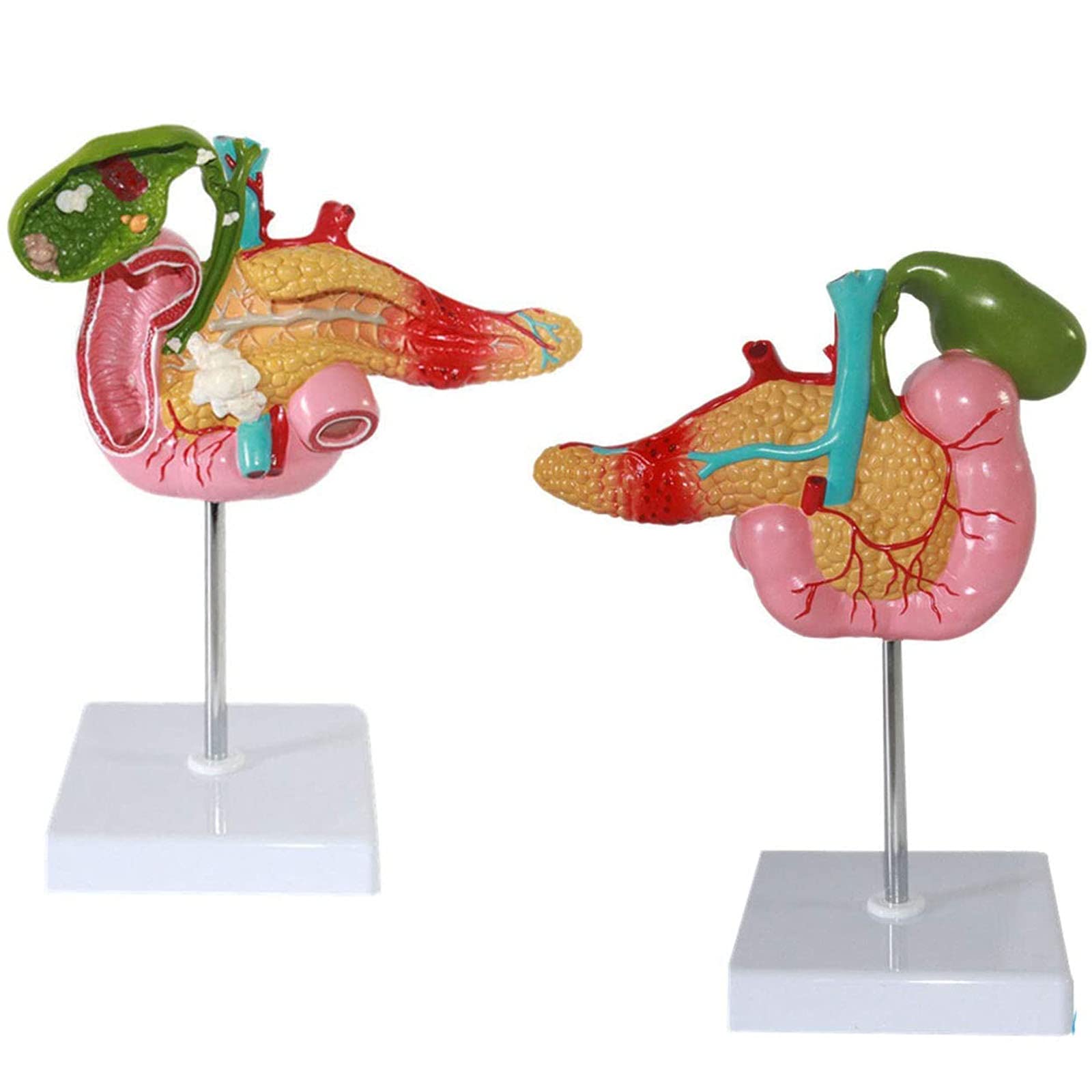 Buy Pathological Model of Pancreas Duodenum And Gallbladder Human Model ...