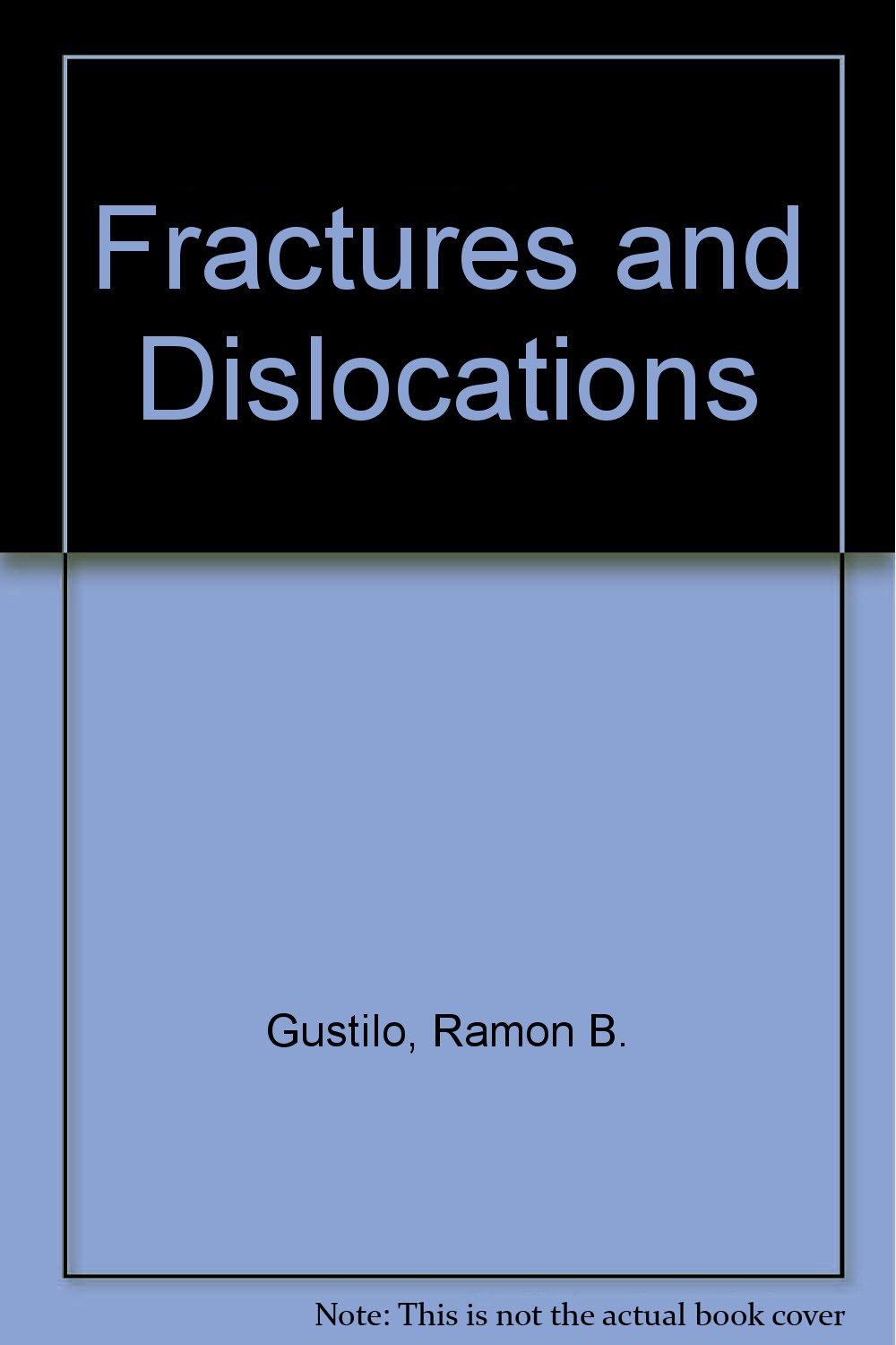 Fractures and Dislocations: Amazon.co.uk: Gustilo, Ramon B., etc., Kyle ...