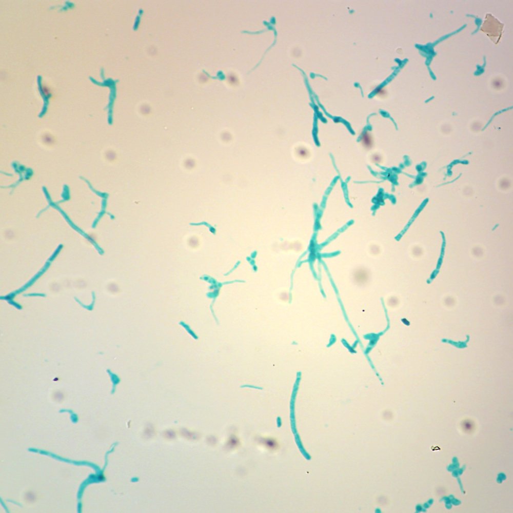 Moss Protonema Slide