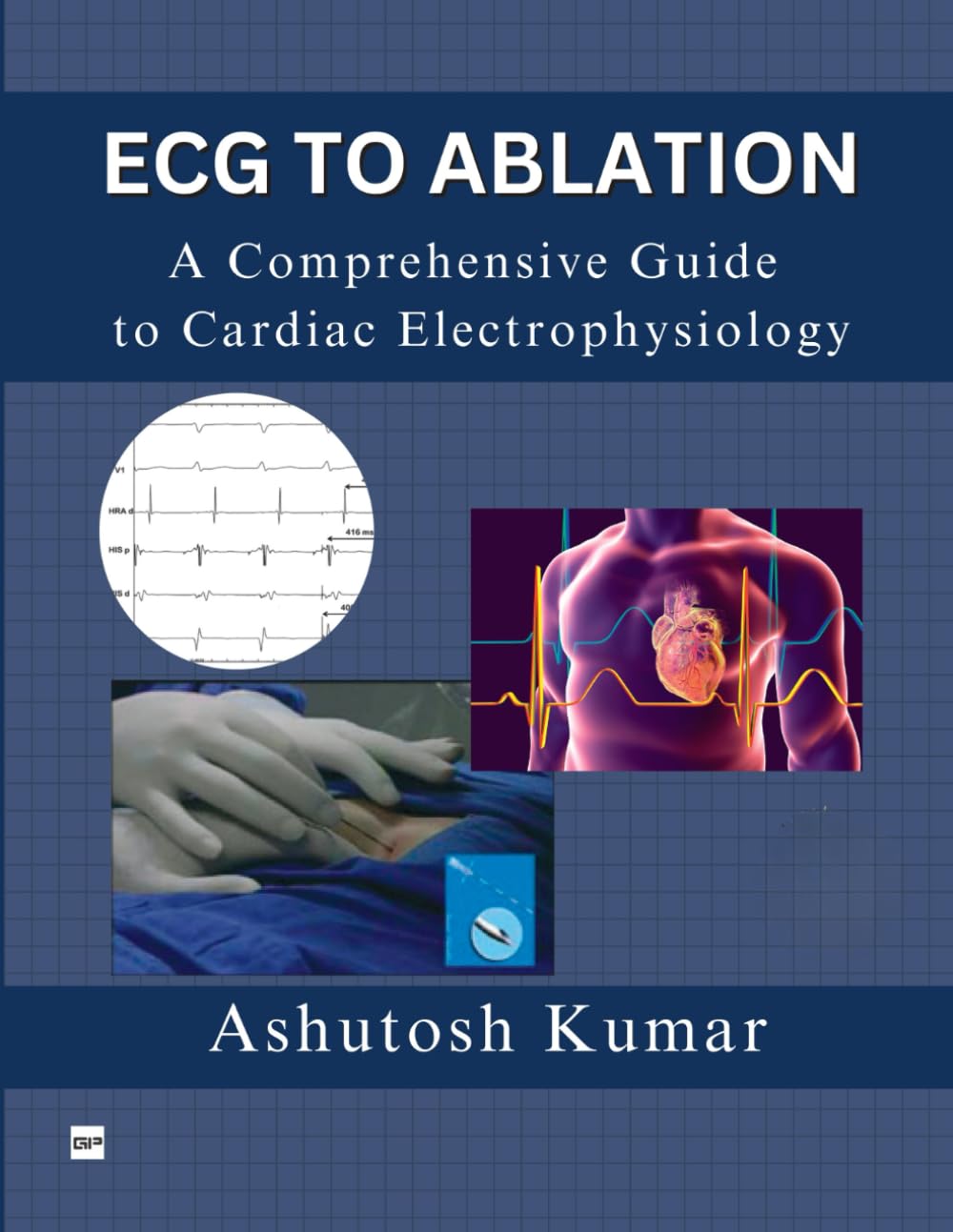 Buy ECG TO ABLATION: A COMPREHENSIVE GUIDE TO CARDIAC ELECTROPHYSIOLOGY ...