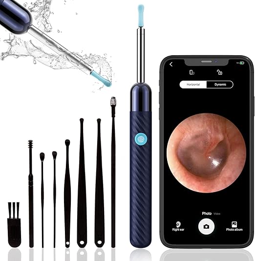 Amazon.com: Ear Wax Removal, Ear Cleaner with Camera(X3) : Health ...