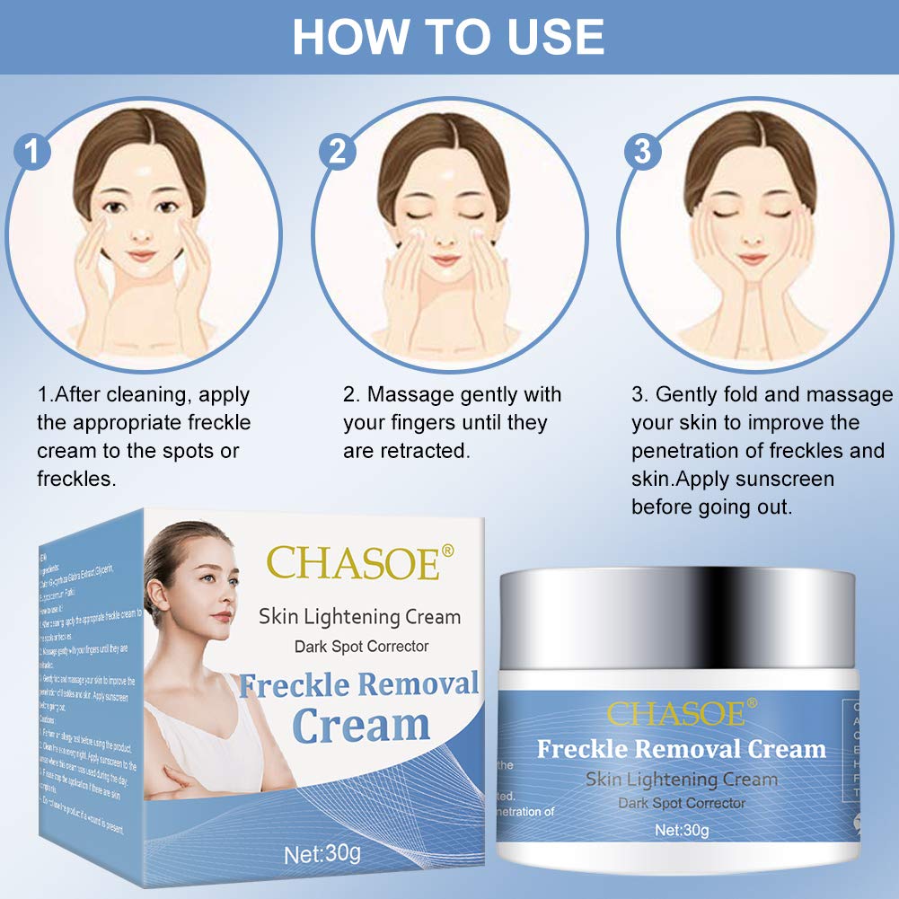 Freckle Removal Cream, Whitening Cream, Lightening Cream, Skin ...