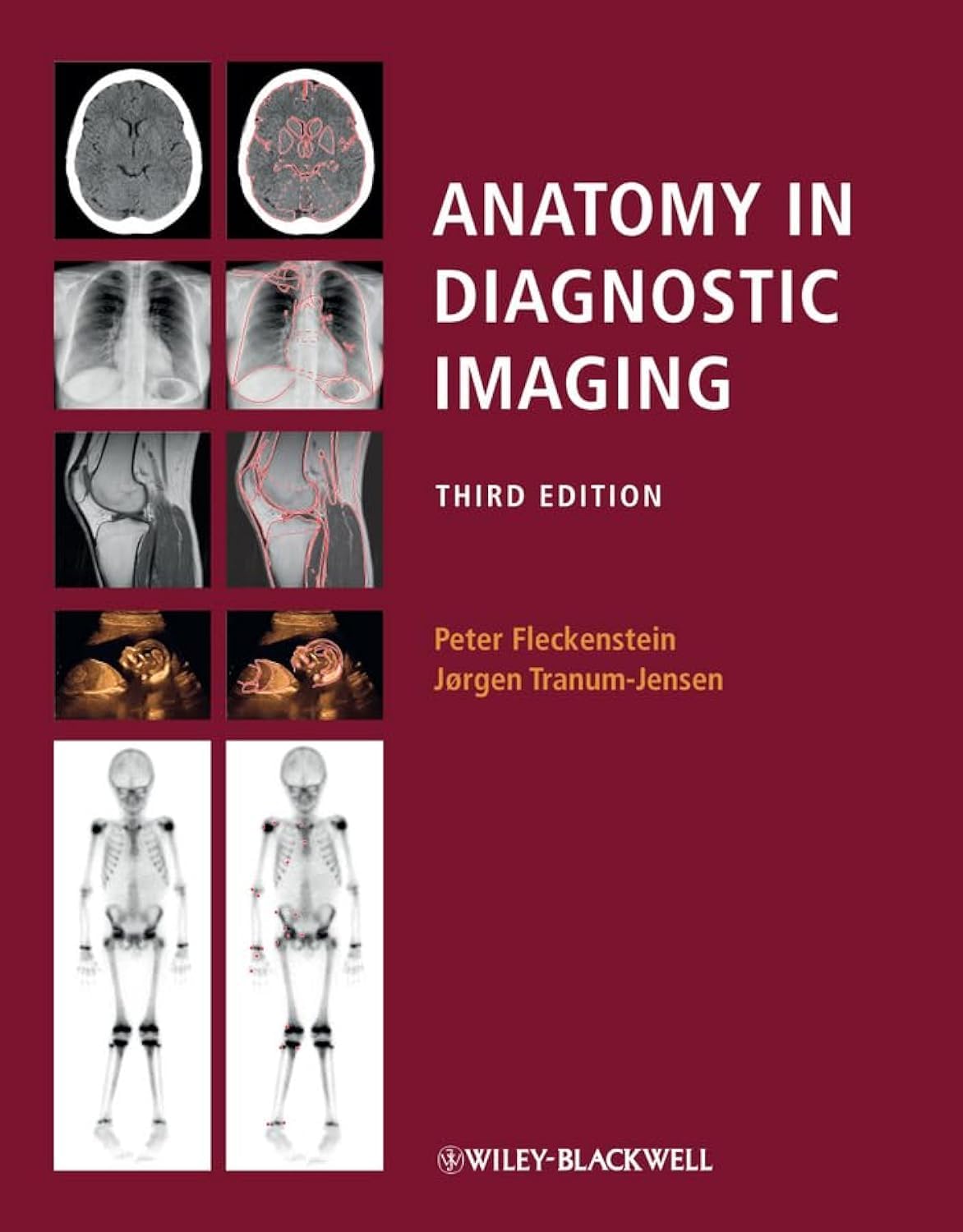 Anatomy in Diagnostic Imaging, 3rd Edition : Fleckenstein, Peter ...
