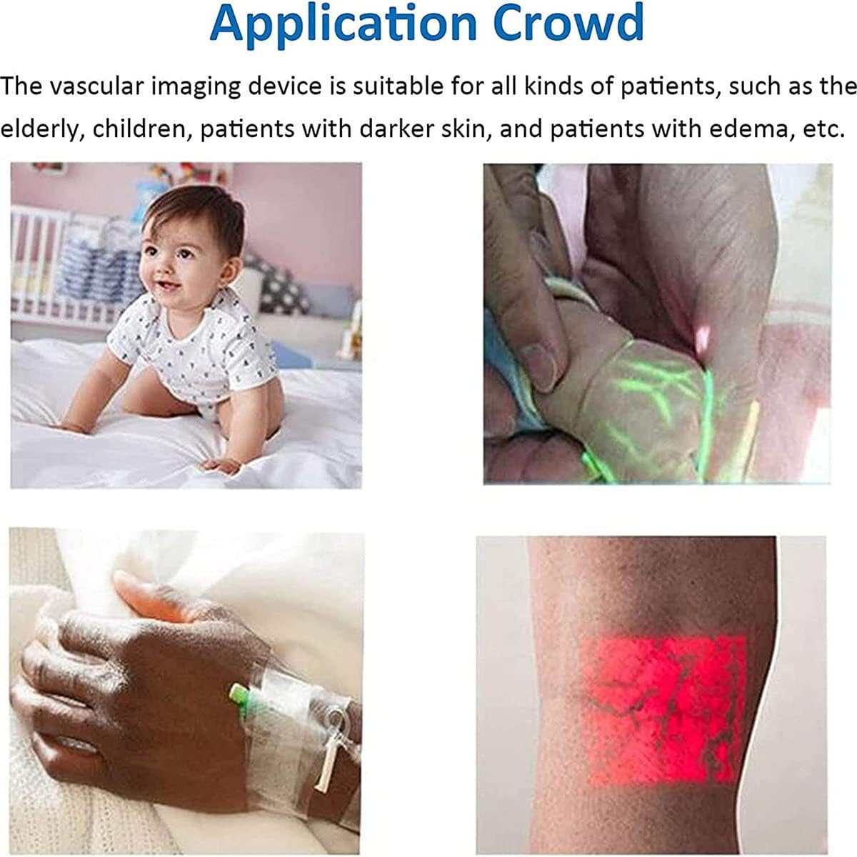 Infrared Vein Finder Medical Infrared Vein Finder Philippines | Ubuy