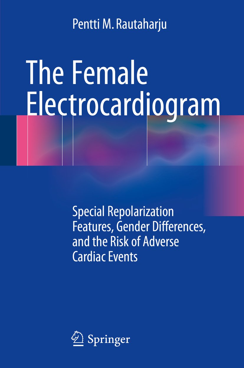 Buy The Female Electrocardiogram: Special Repolarization Features ...