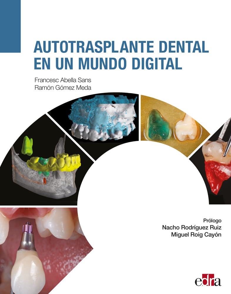 Amazon.com: Autotrasplante dental en un mundo digital: 9788419156044 ...