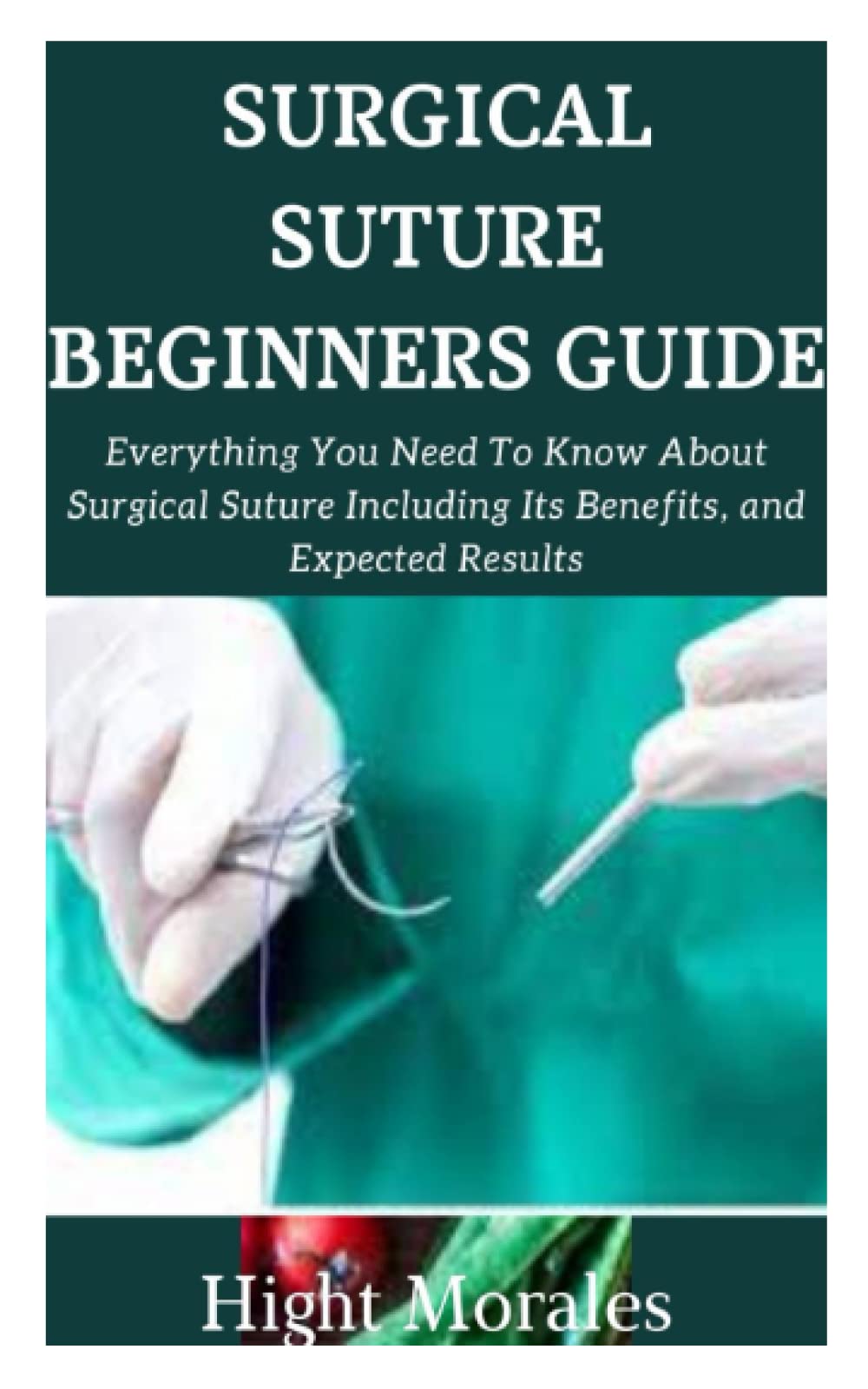 Buy SURGICAL SUTURE BEGINNERS GUIDE: Everything You Need To Know About ...