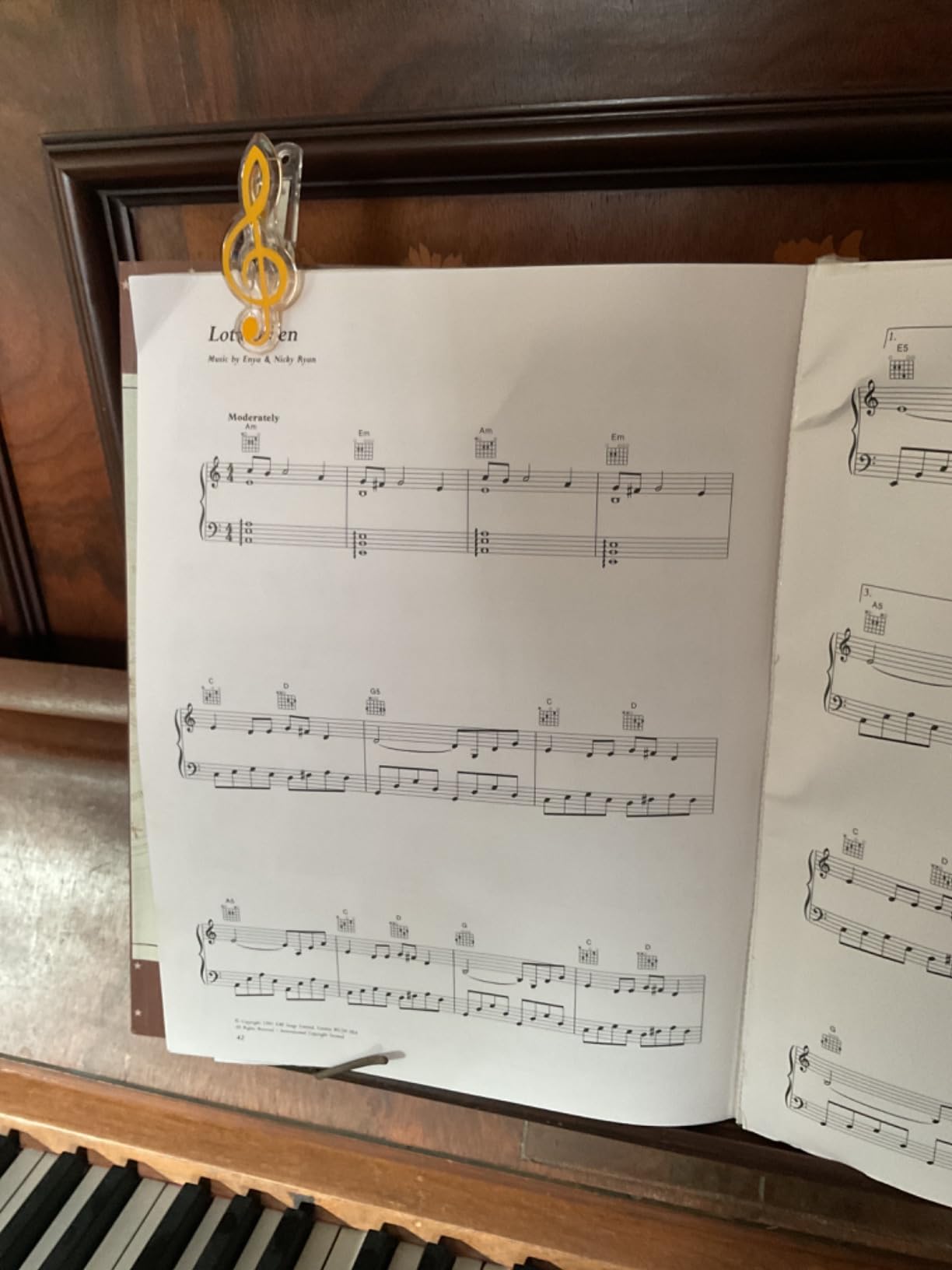 PATIKIL Music Note Clips, 40pcs Music Paper Clip Holder, Plastic Music ...