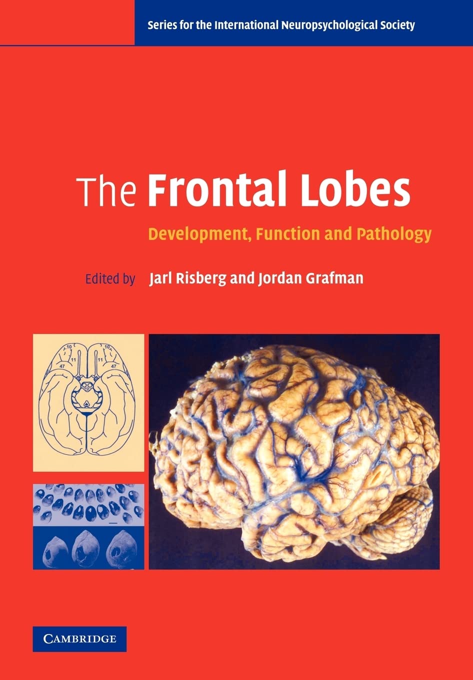 The Frontal Lobes: Development, Function and Pathology (Series for the ...